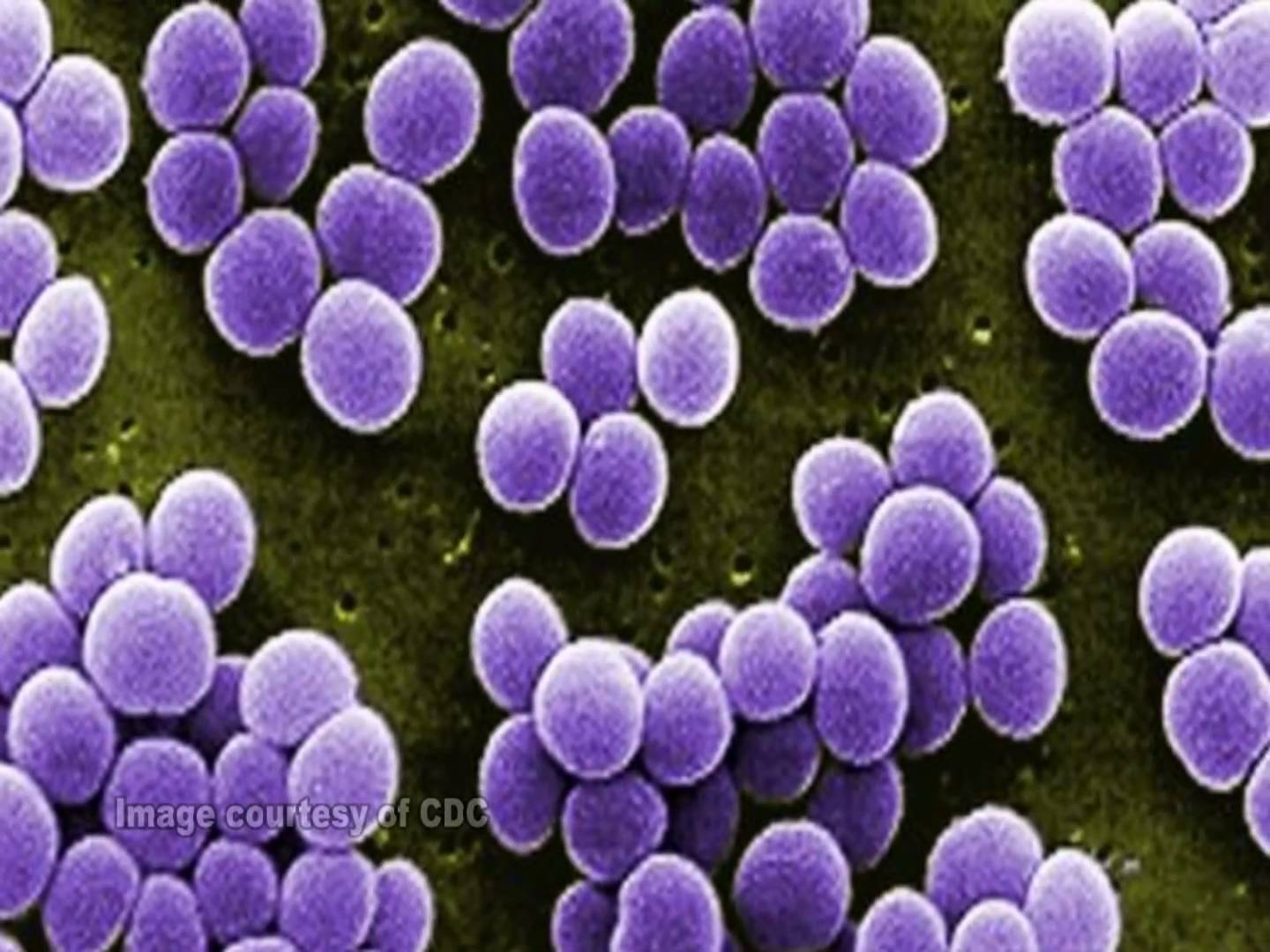 staph bacteria - pictures, photos